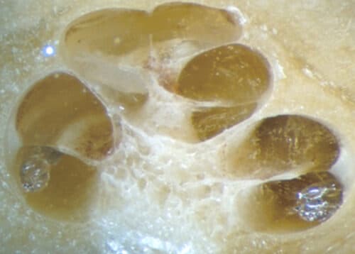 Pictures of the Ear: Deep in the Cochlea | The MED-EL Blog