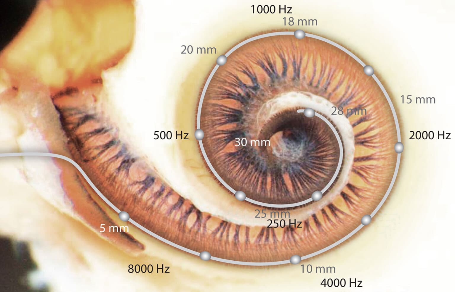 How the Ear Hears Sound | The MED-EL Blog