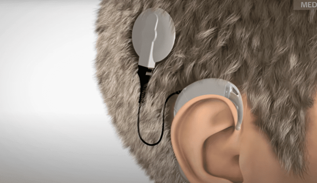 Tips For Teachers of Students with Cochlear Implants - The MED-EL Blog