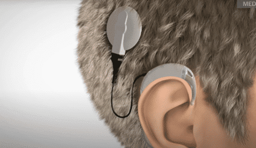 Tips For Teachers of Students with Cochlear Implants - The MED-EL Blog