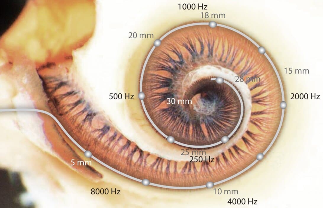 Low Frequency Sounds with a Cochlear Implant