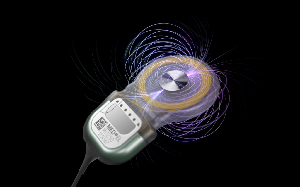The Complete Guide to MRI With a Cochlear Implant - The MED-EL Blog