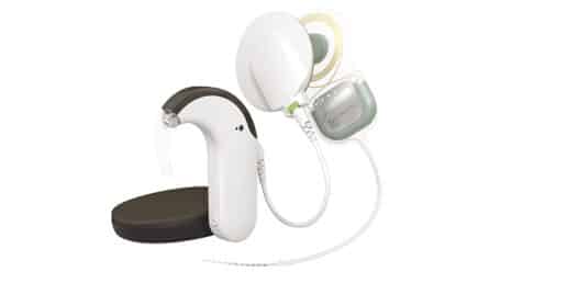 Cochlear Implant Myths and Facts - The MED-EL Blog