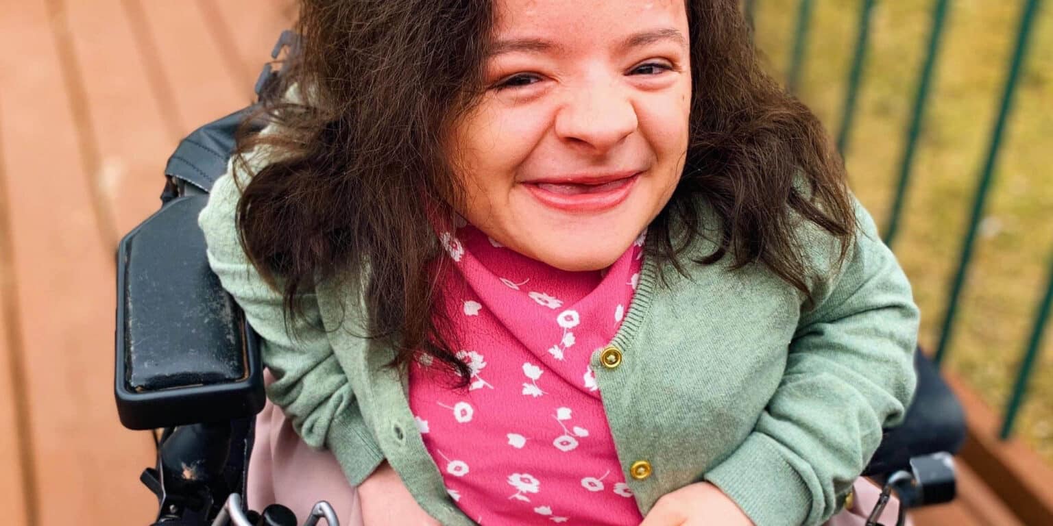 “We All Deal With Challenges. Mine Just Happens to Be Visible ...