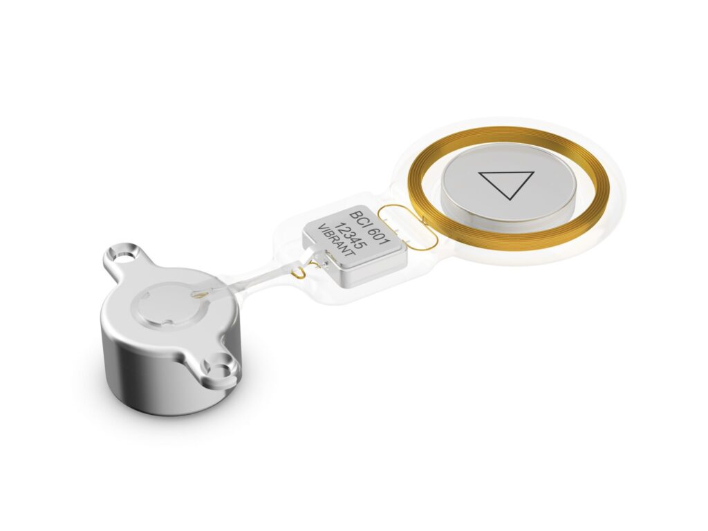 What Makes the BONEBRIDGE So Special? : MED-EL Blog