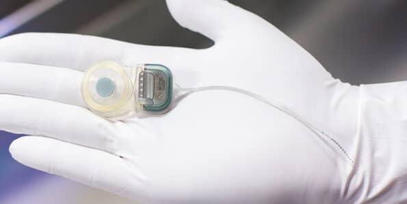 Koklear İmplant Nedir? - The MED-EL Blog