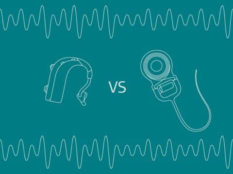 Hearing Aids vs. Cochlear Implants: What’s the Difference? - The MED-EL ...