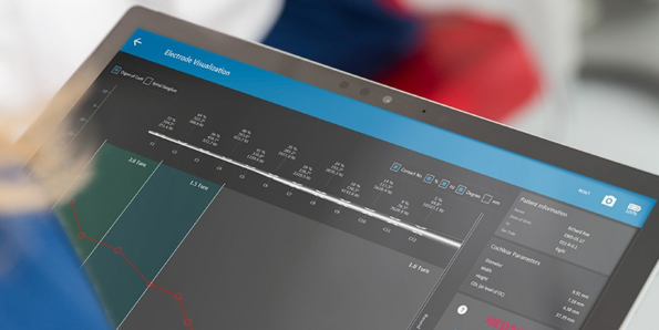 The History of MED-EL Electrode Arrays | The MED-EL Blog